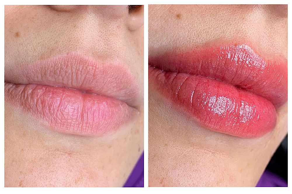 Descubra o segredo da revitalização labial com Giovanna Beauty em Atibaia